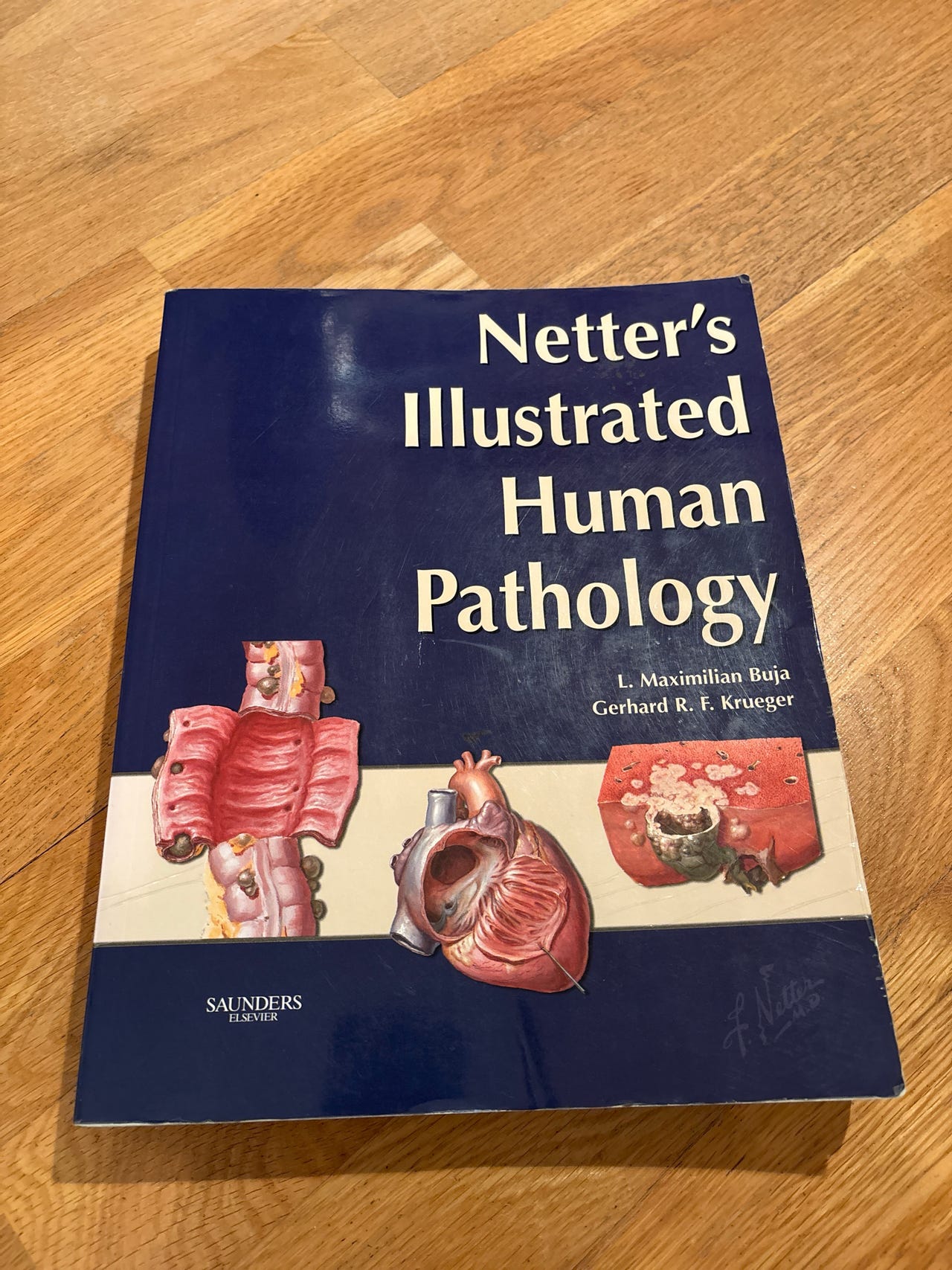 Netter’s Illustrated Human Pathology | FINN-torget